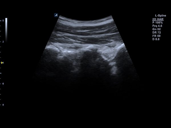 Ultrasonido Alpinion 4D Ecube 8 – Slim Royal S.A. DE C.V.